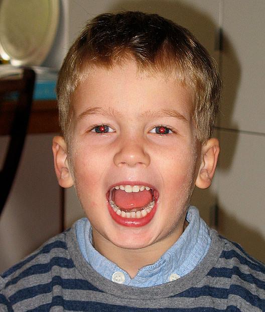 The Red Eye Effect: What It Is, Avoiding It, and Removing It ...